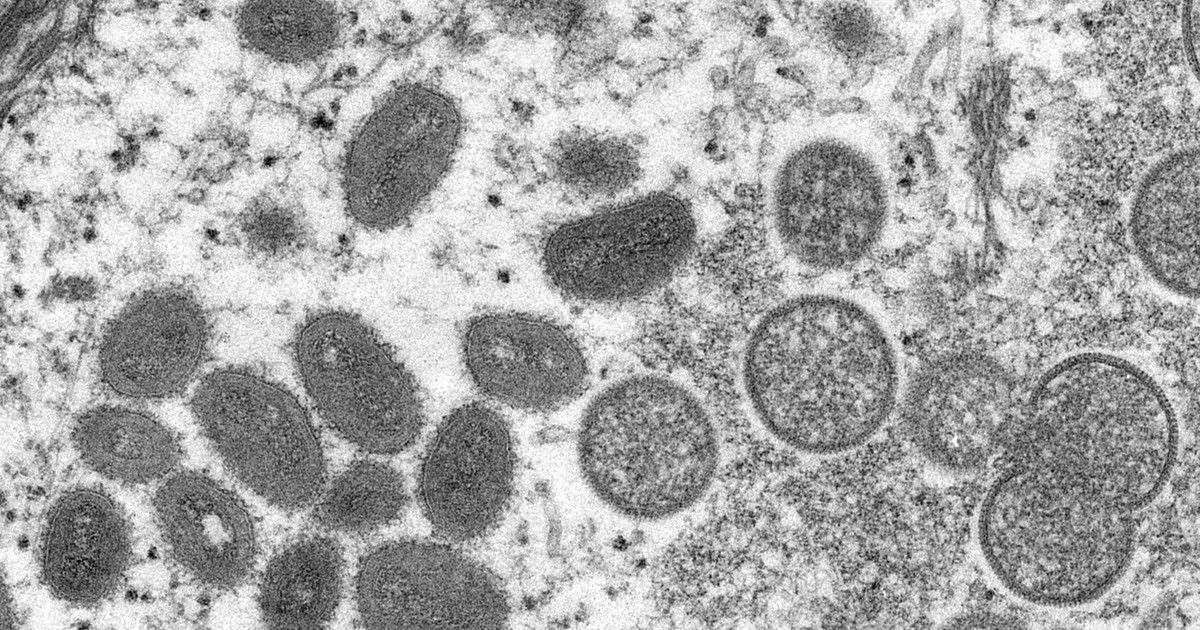 Experts are racing to contain 'the most dangerous' monkeypox virus yet ...