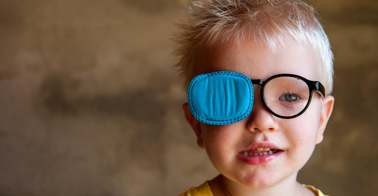 Zez - przyczyny, rodzaje, diagnostyka. Czy zeza można leczyć?