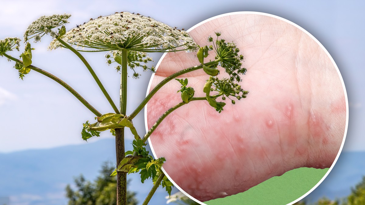 (Foto) u Srbiji se nastanila "biljka ubica": Izgleda kao prelep cvet, a ...