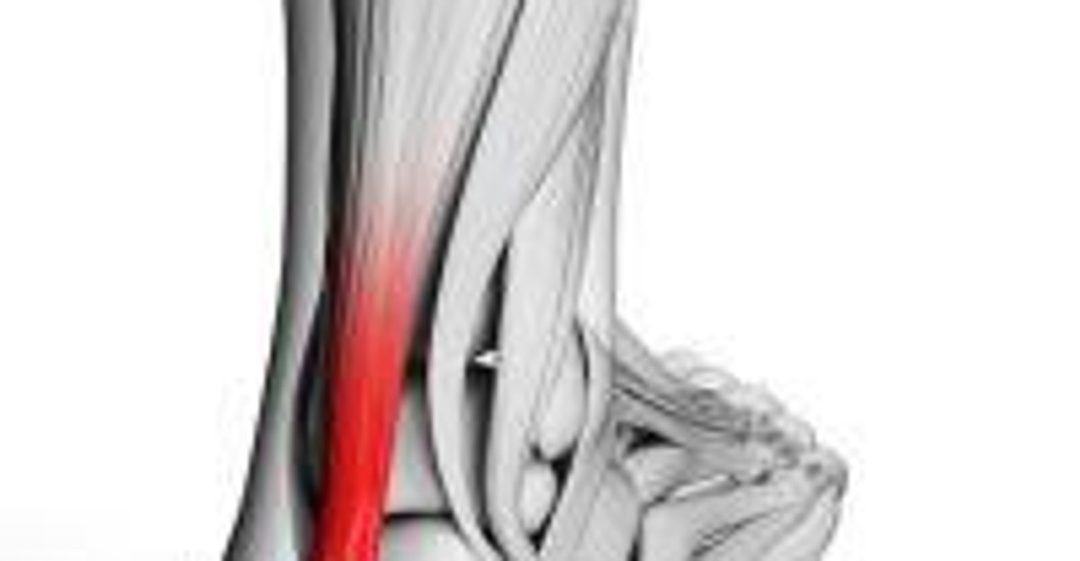 Fortflex - skład preparatu, działanie i zastosowania