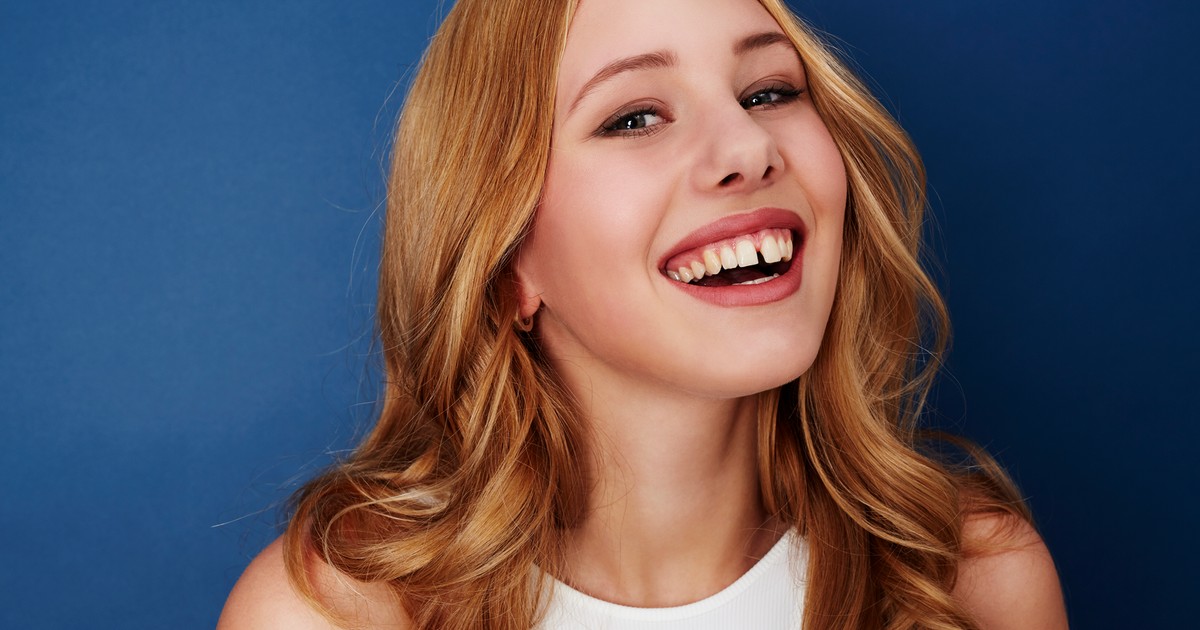 Diastema - przyczyny, rodzaje, typy, leczenie - Zdrowie