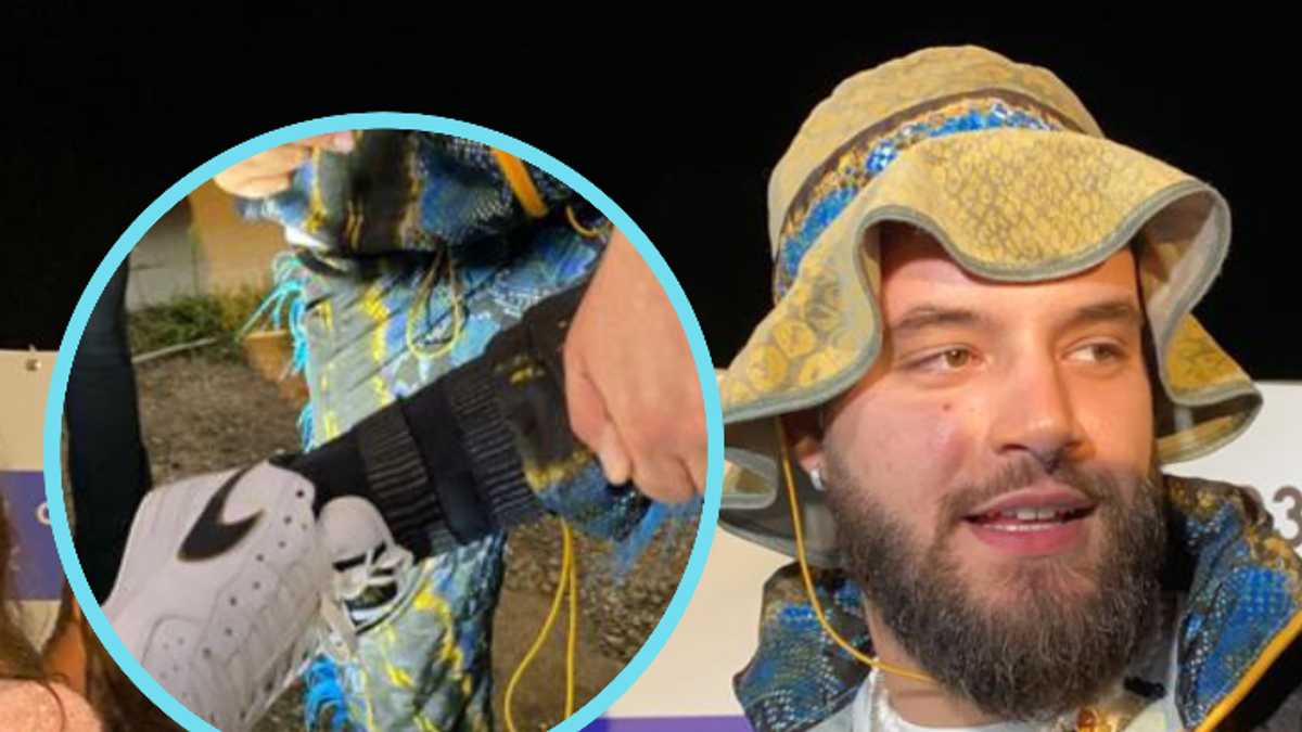 nucci pevac music week povreda noga nastup steznik - Blic