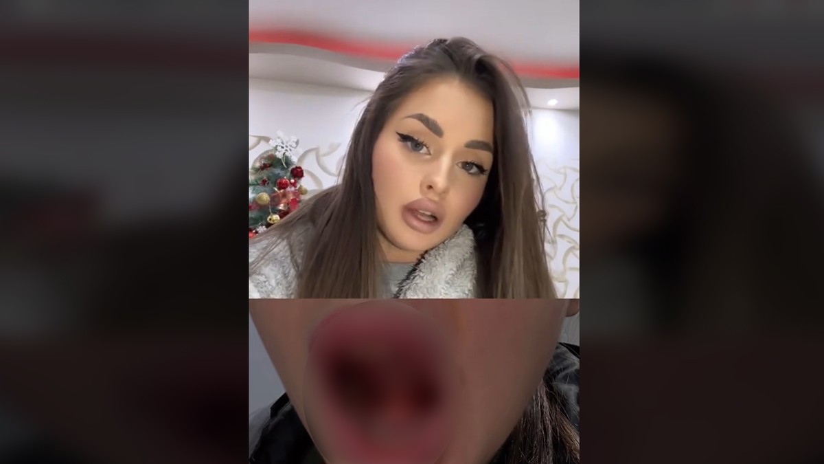 Emilija otišla na bezbolan tretman, pa prošla pakao: "Zubarka mi je probušila usnu duplju" - Blic