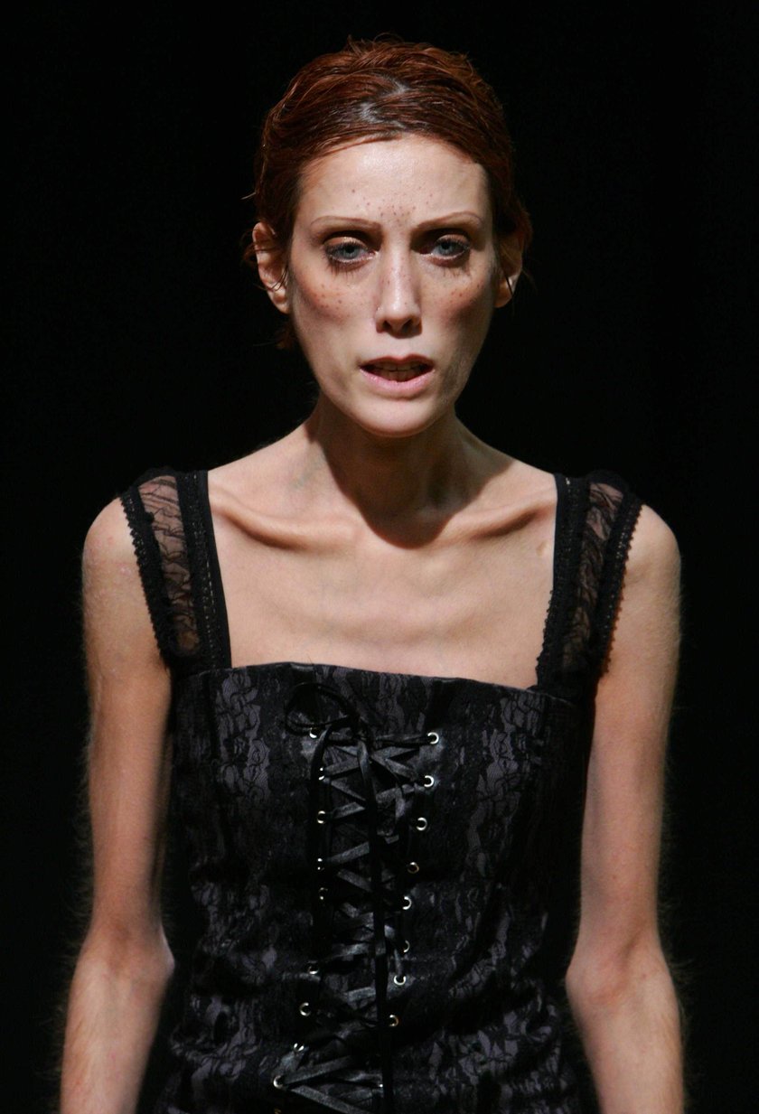 Tragiczne losy supermodelek