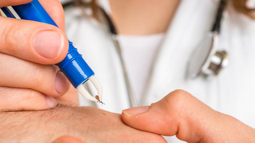 Lyme-kór fertőzés: ilyen krónikus betegségekkel keverhetők össze a ...