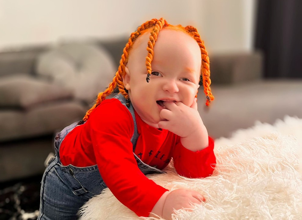 Vörös hajú albínó babája született egy fekete párnak - Blikk