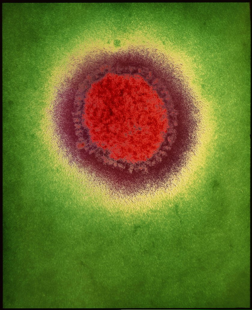 Za kilka dni uderzy epidemia! Szczególnie narażone są dzieci! Za kilka dni uderzy epidemia! Szczególnie narażone są dzieci!