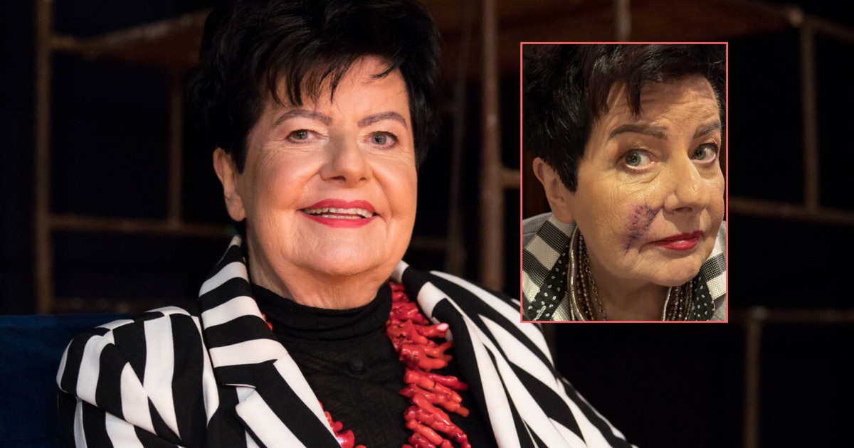 Niepokojące zdjęcie Joanny Senyszyn po zabiegu. "Straszę wyglądem ...