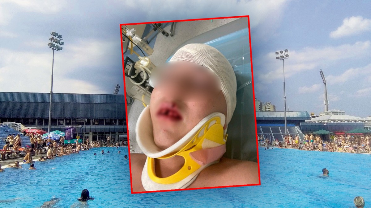 Dečak iz Niša teško povređen prilikom skoka u bazen na Čairu, evo kakav apel ima njegova majka ...