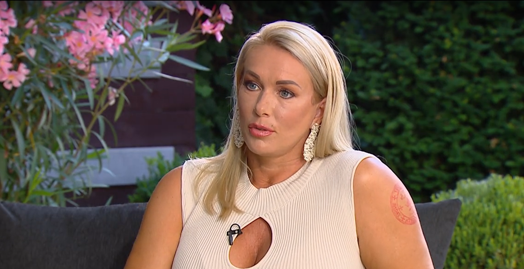 Molnár Anikó ismét kés alá feküdt, kivágtak egy darabot a bőréből: íme ...