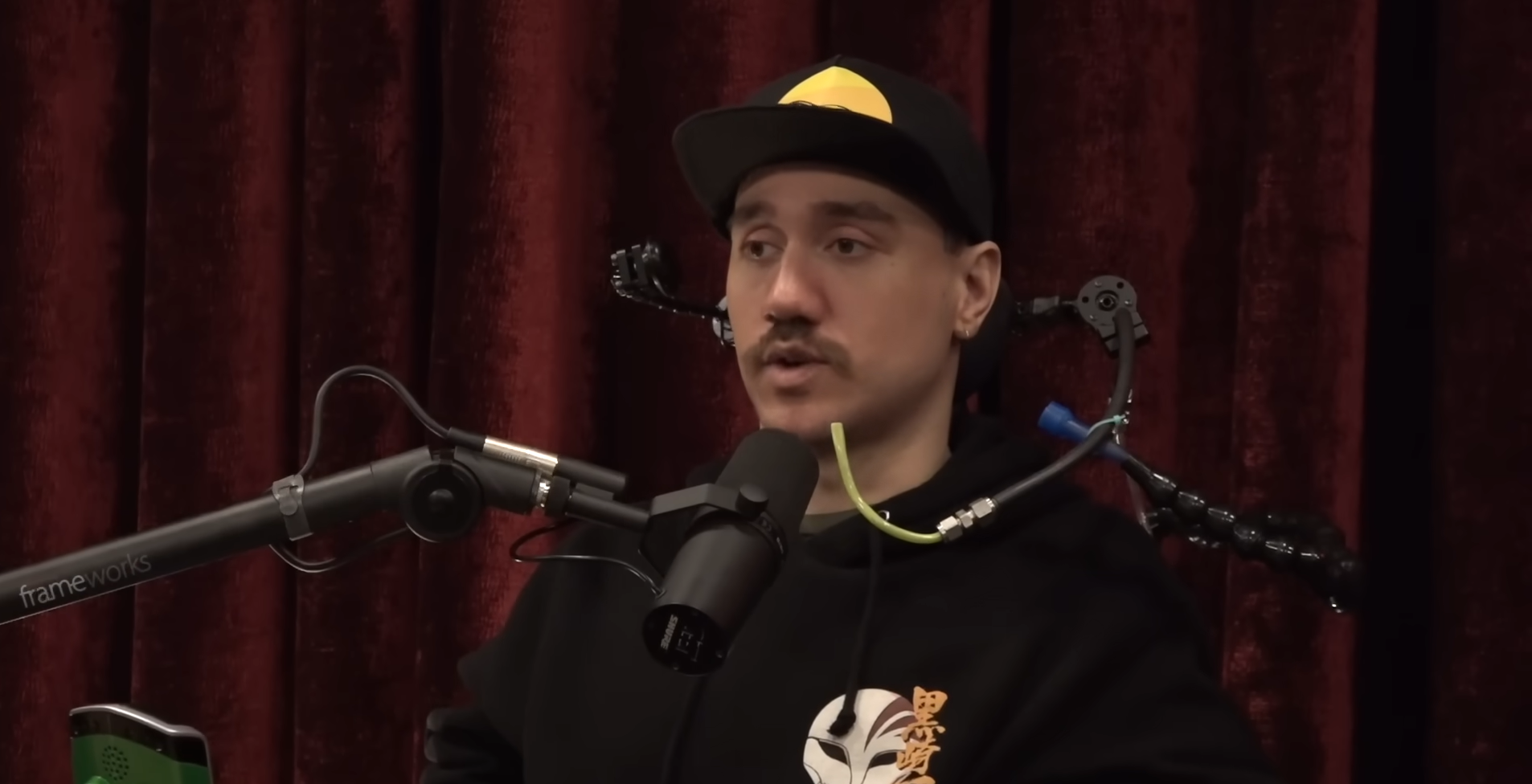 Hátborzongató beszámolót tartott az első ember, aki megkapta Elon Musk ...