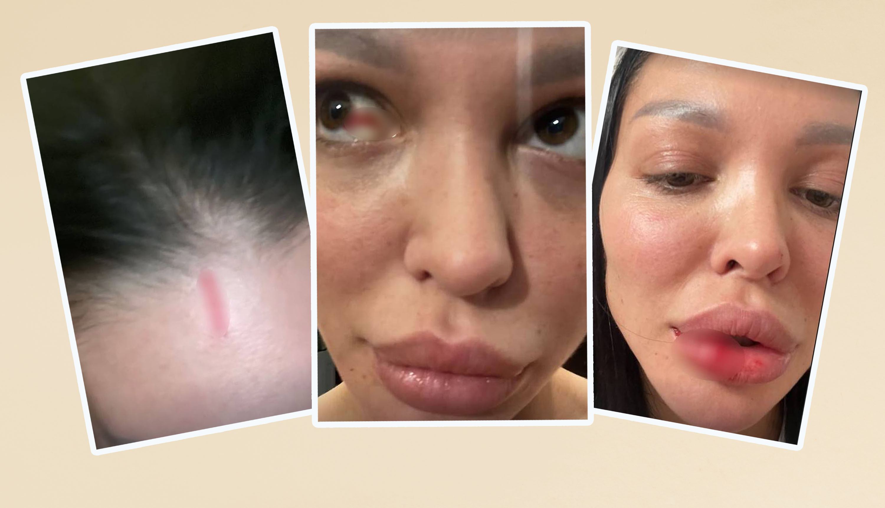 Maja Marinković optužila Filipa Cara za nasilje, objavila fotke u podlivima i modricama