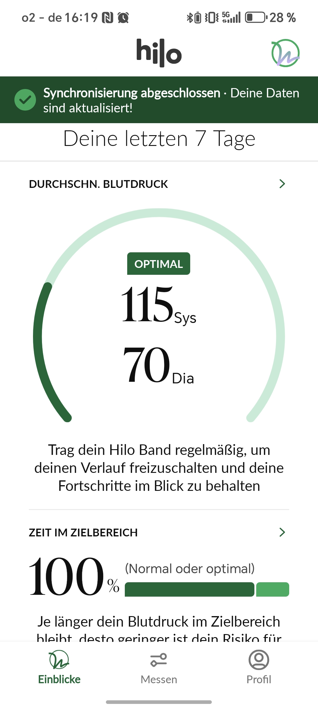 Hilo Band im Test: Permanentes Blutdruckmessgerät fürs Handgelenk ...
