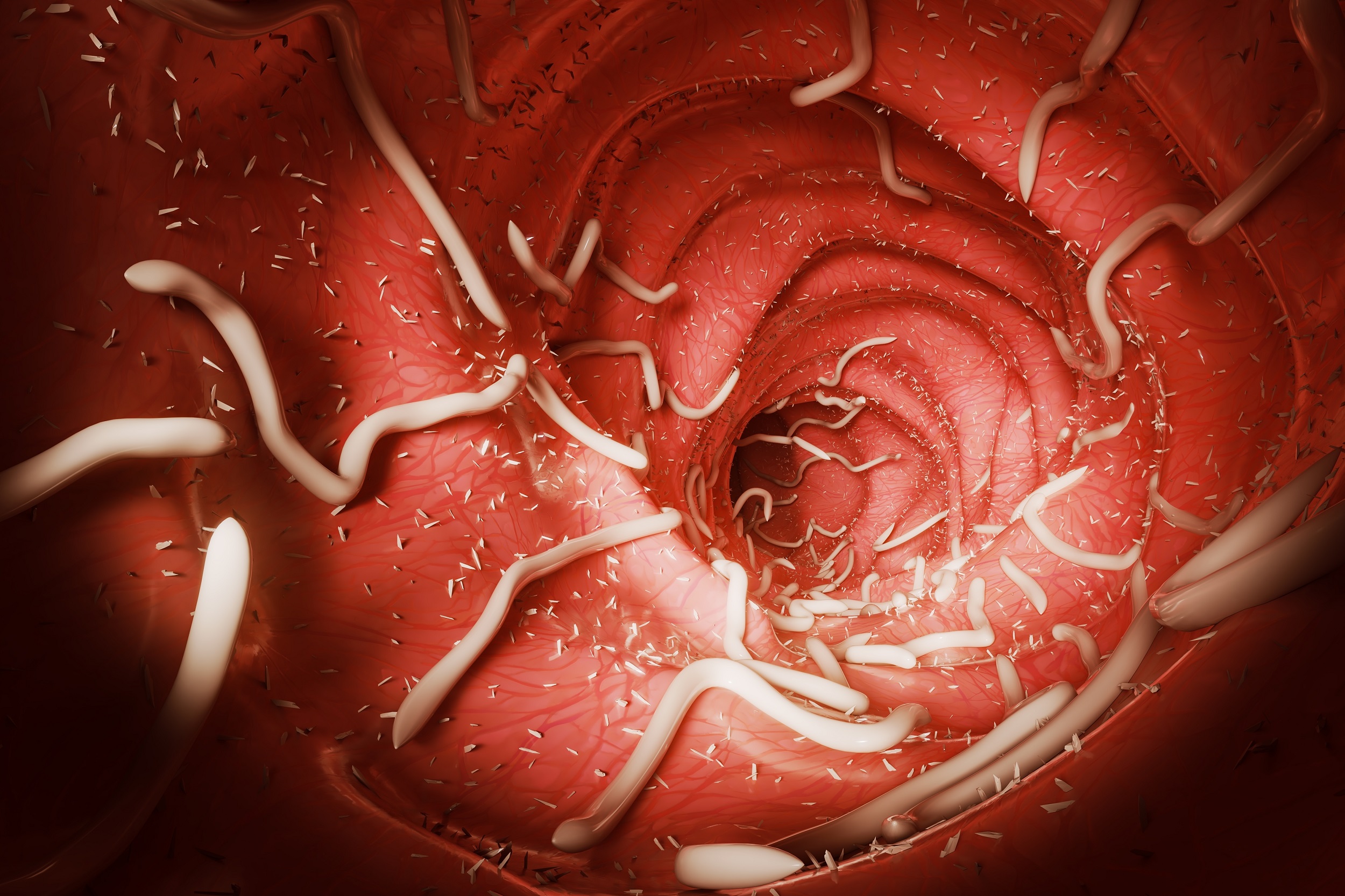 Orsóféreg fertőzés tünetei: nagy számban összegyűlve ezt művelik a ...