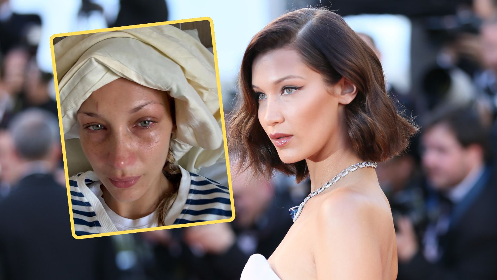 Bella Hadid ma nawrót choroby. Aniołek Victoria's Secret pokazał ...