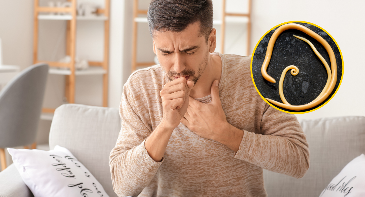 Glista ludzka - objawy zakażenia. Jak leczyć glistnicę? - Medonet