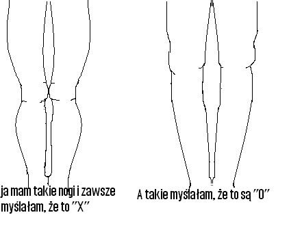 Jak wyglądają krzywe nogi? :O - Zapytaj.onet.pl