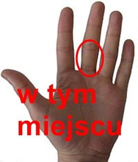 Nagle spuchł mi palec, od czego? (dokładny opis niżej) - Zapytaj.onet.pl